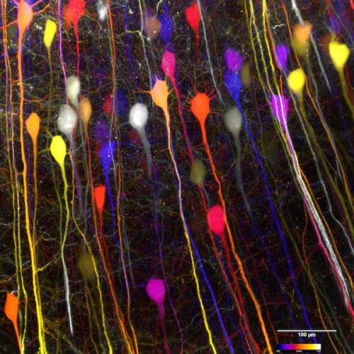 Neural connections observed with light-sheet microscopy | Electro Optics